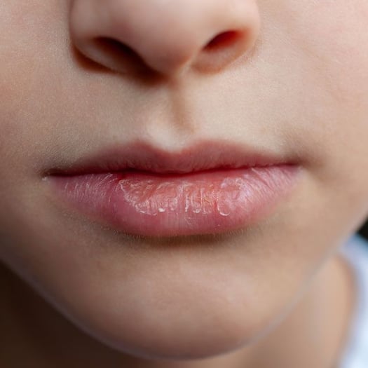 Hidratar Labios - Consejos, Remedios caseros & Productos