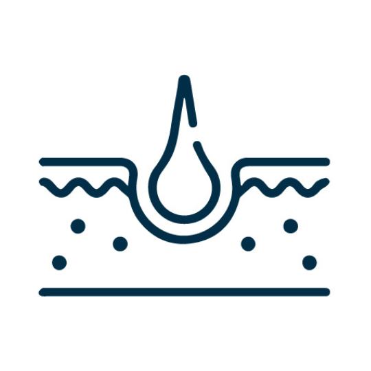 La mejor crema para codos secos: hidratación y cuidado